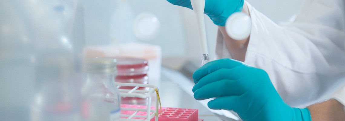 Our products | ImmuView